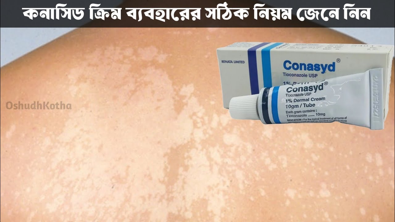 কনাসিড ক্রিম ব্যবহার এর উপকারিতা কি? | Conasyd Cream (Tioconazole 1% ...