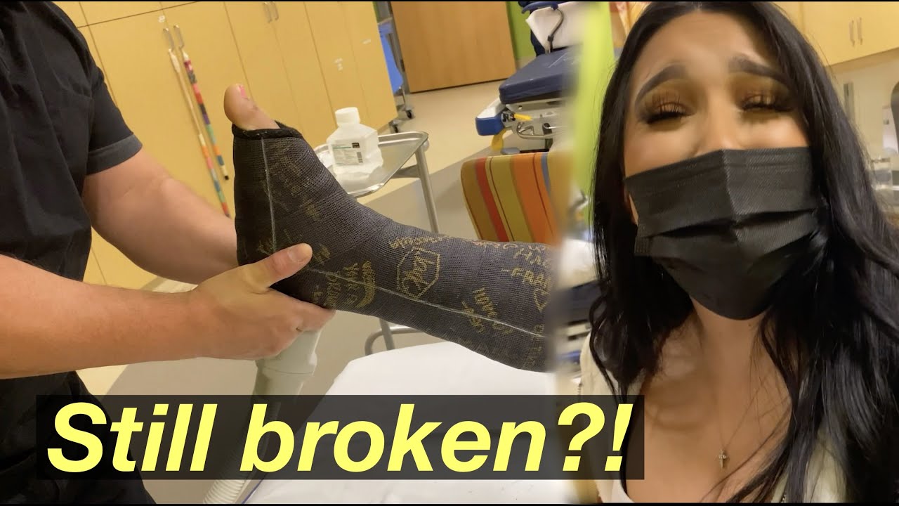 GETTING MY LEG CAST REMOVED!! (SO EXCITED) *MUST WATCH* - YouTube