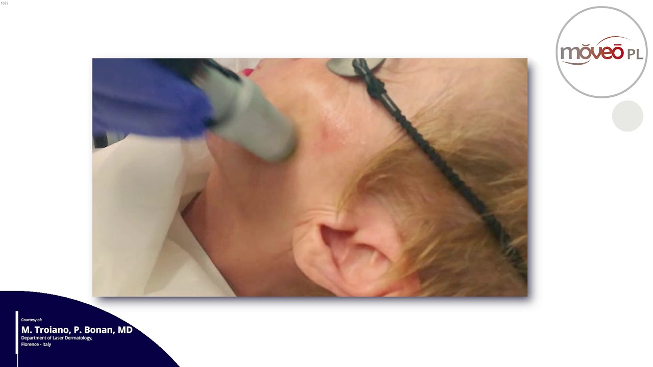 MOVEO PL - Face Treatment 1 - YouTube