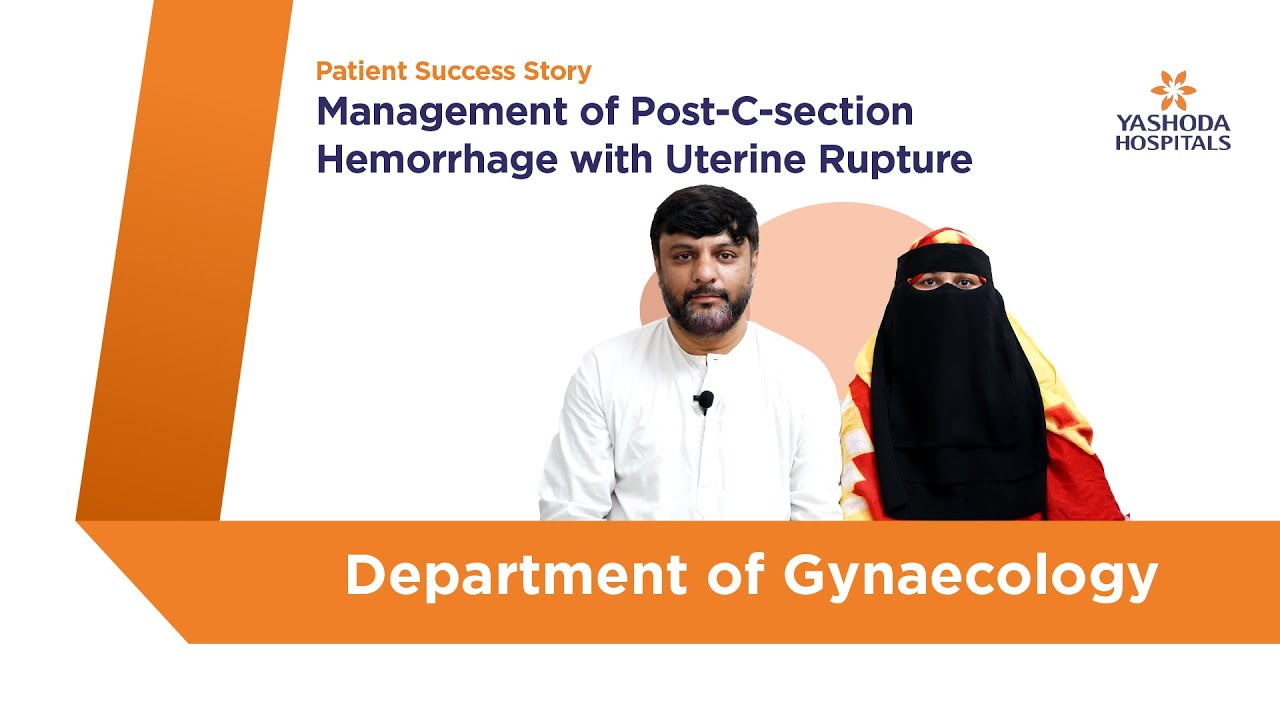 Management of Post C-Section Hemorrhage with Uterine Rupture | Yashoda ...