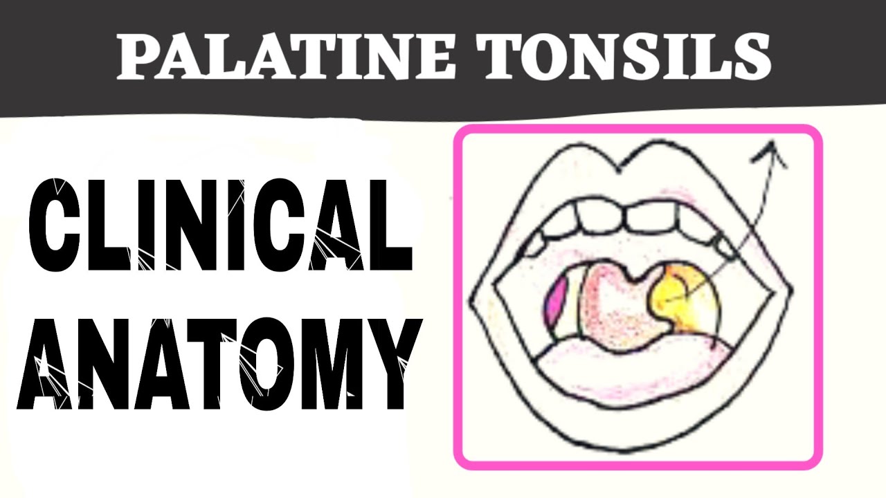 PALATINE TONSIL- CLINICAL ANATOMY! - YouTube