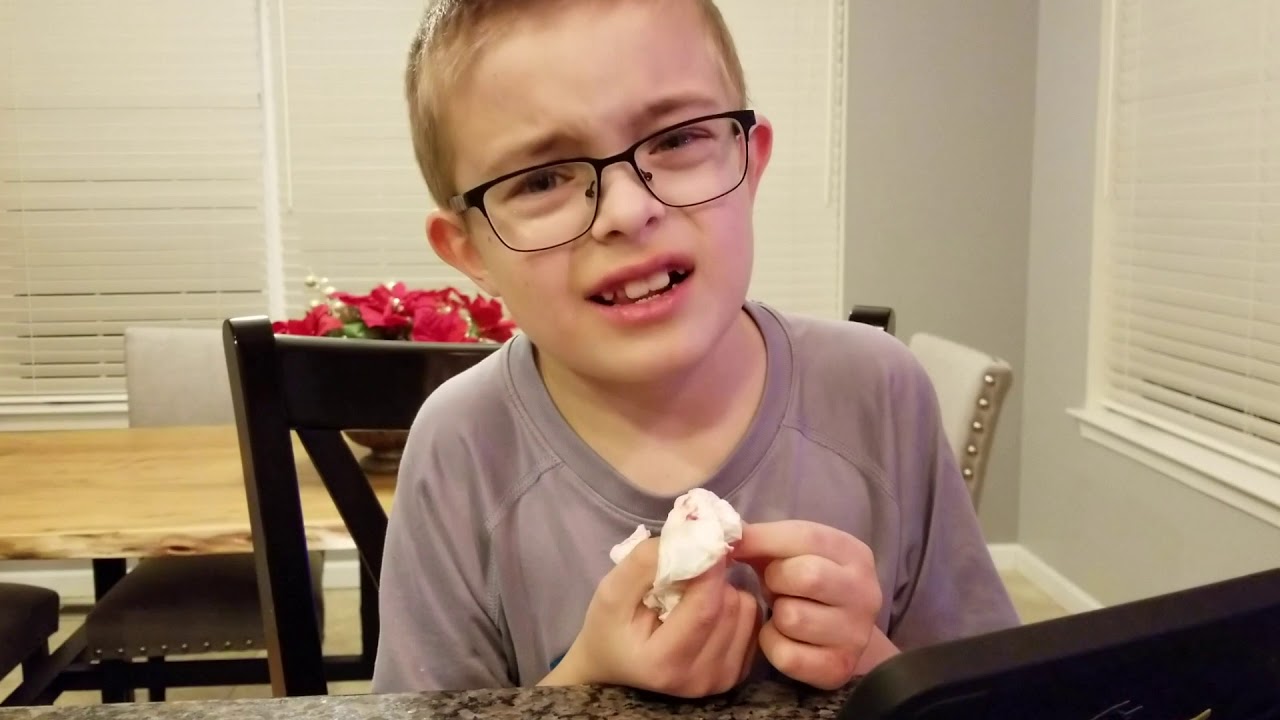 I Lost Another Tooth!! | Tooth Pull - YouTube