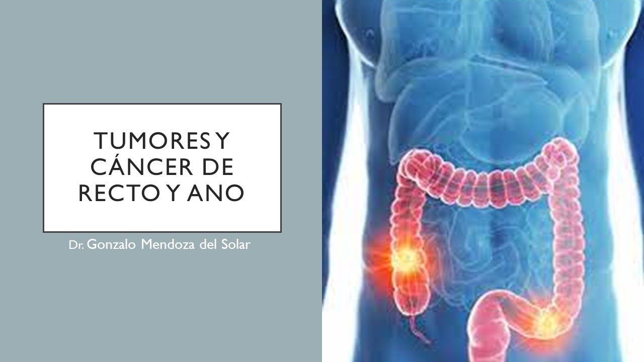 CIRUGÍA II (FASE II) - TUMORES Y CÁNCER DE RECTO Y ANO - YouTube