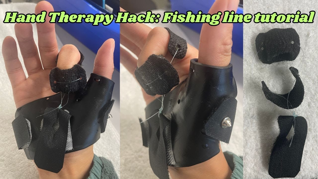 Static progressive digit flexion orthosis: fishing line technique - YouTube
