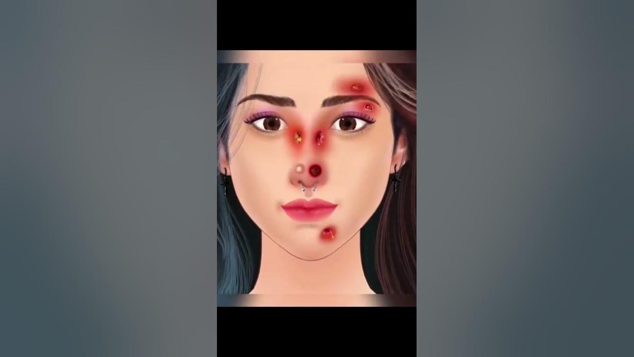 Asmr Treatment Of Infections Caused By Wearing Facial Piercings 얼굴 피어싱