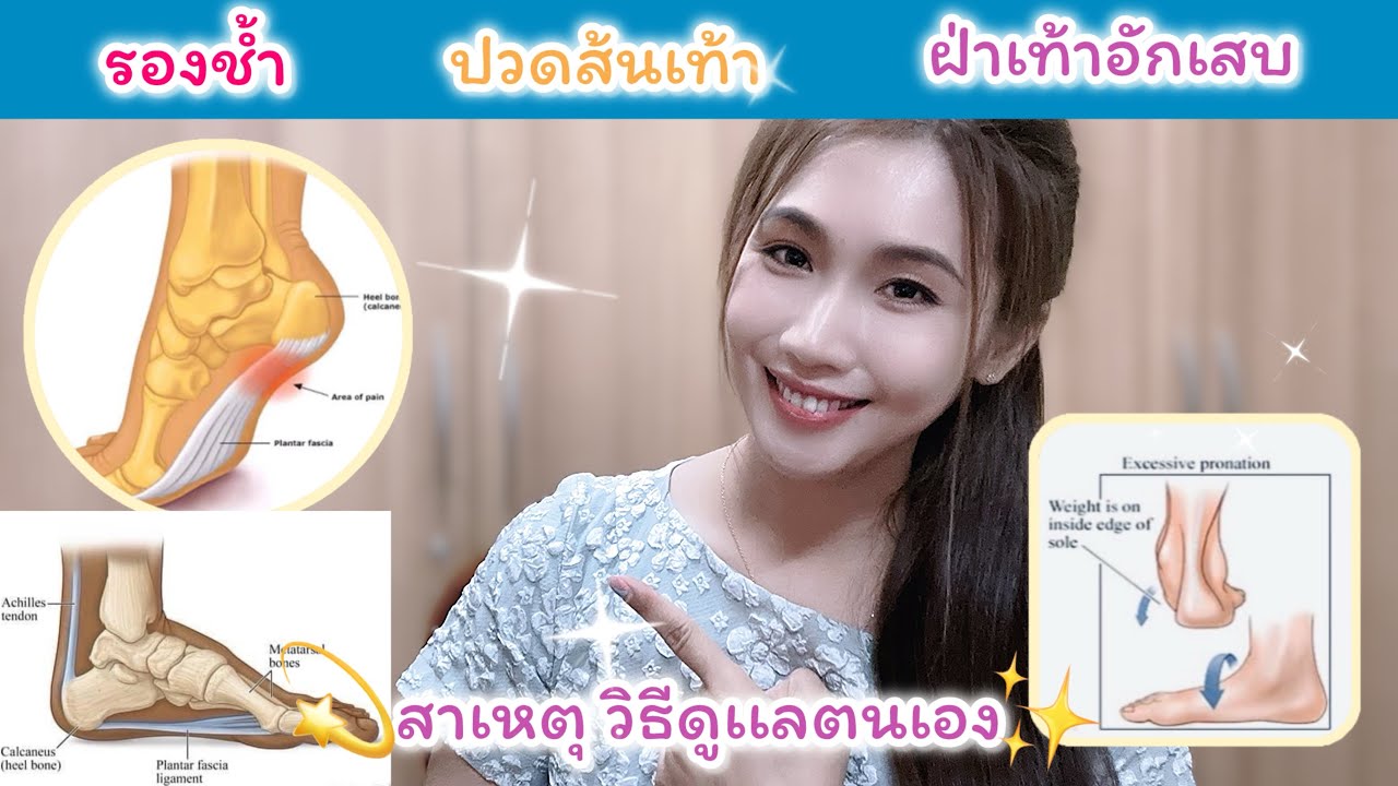 รองช้ำ ปวดส้นเท้า ฝ่าเท้าอักเสบ|PTไข่มุก @mukdawanphysio - YouTube