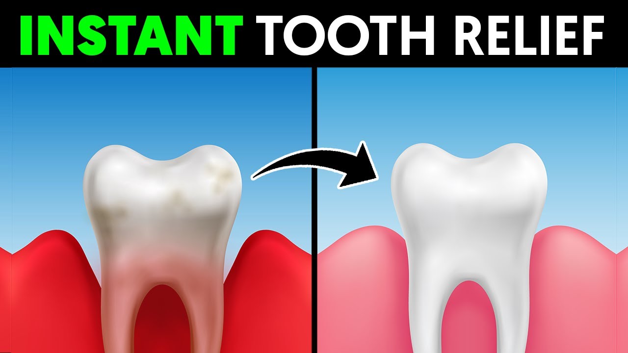 Do this for INSTANT toothache relief (Home remedy) - YouTube