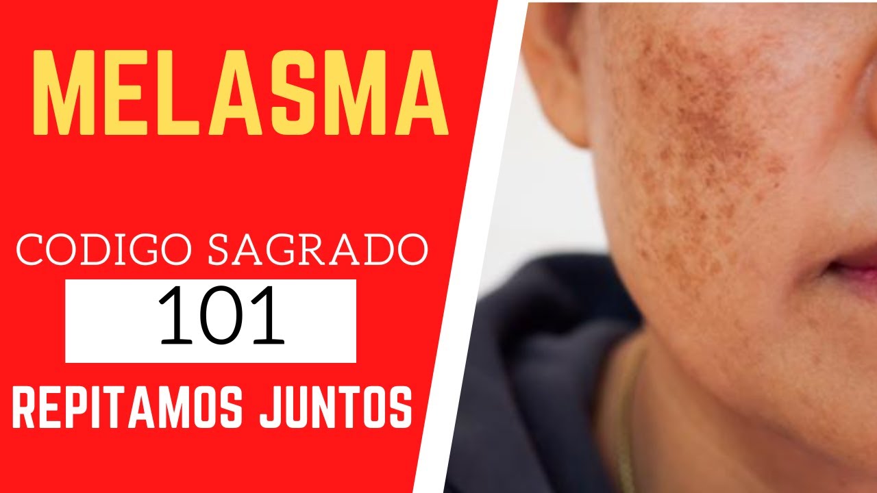 🙏 Código Sagrado 101 para controlar el MELASMA (cloasma ...