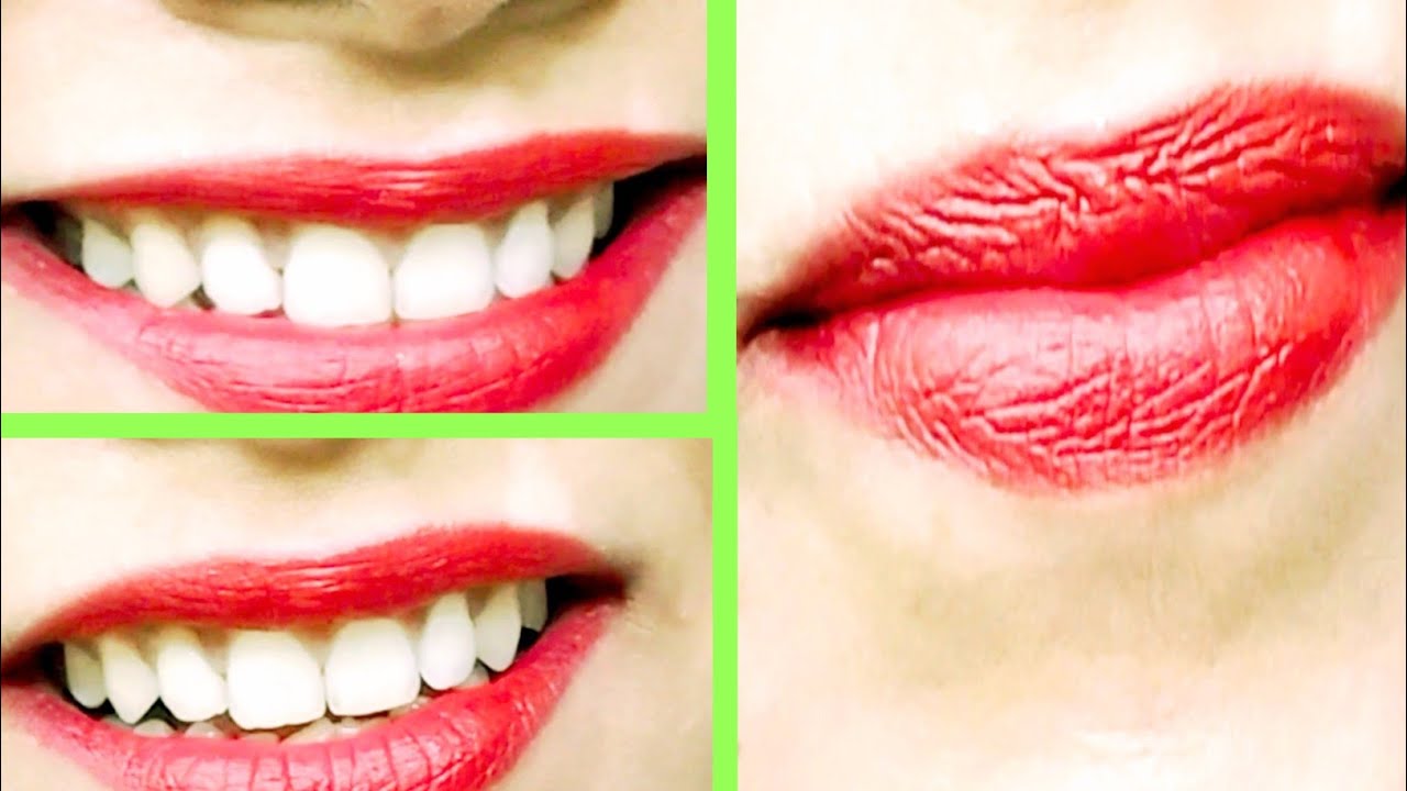 Teeth zoom 😬 smile zoom 🙂//Teeth and smile zoom //requested video part ...