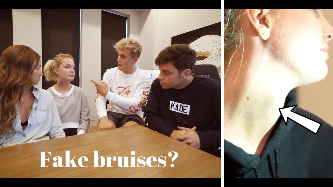 Proof that Jake Paul's assistant bruises were fake? - YouTube