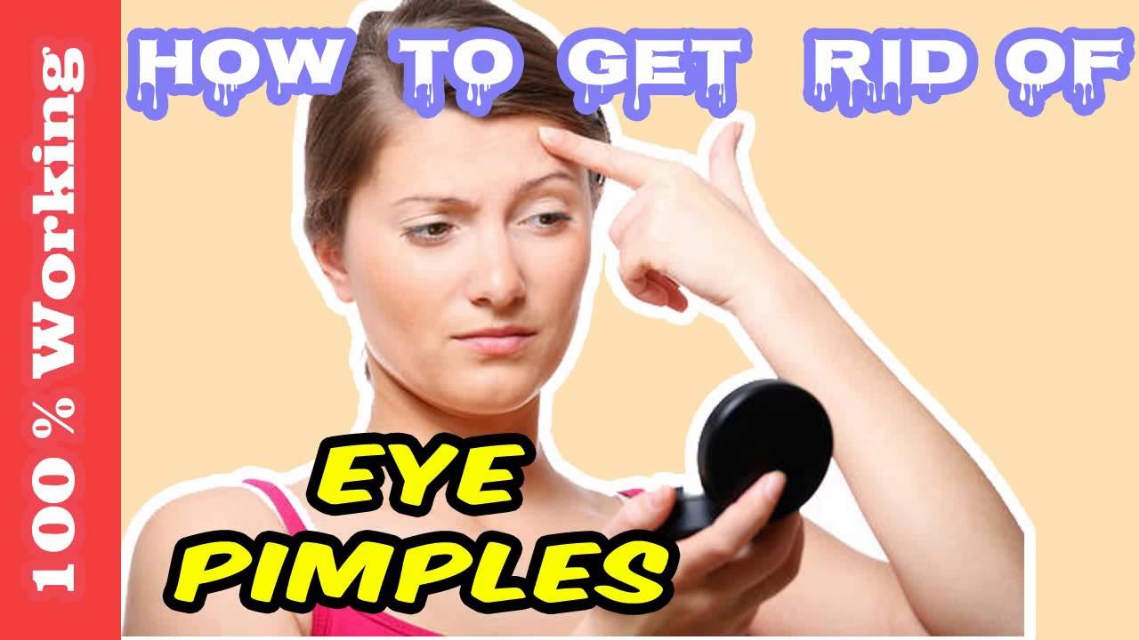 How To Get Rid Of Pimples On Eyelids Overnight Fast Home Remedies how-to-get-rid-of-pimples-on-eyelids-overnight-fast-home-remedies
