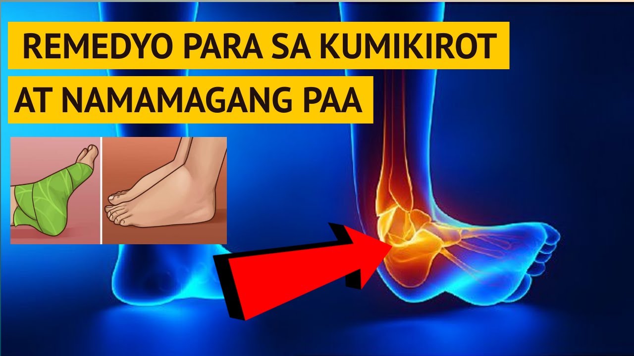 GAMOT, LUNAS AT REMEDYO PARA SA KUMIKIROT AT NAMAMAGANG PAA | TAGALOG ...