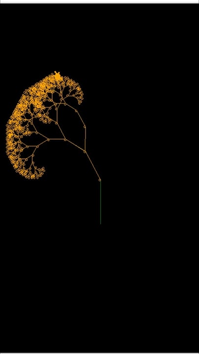 Python Turtle Tree Drawing Recursive Tree Art Python Beginnerpython Codingchallenge Youtube 3422