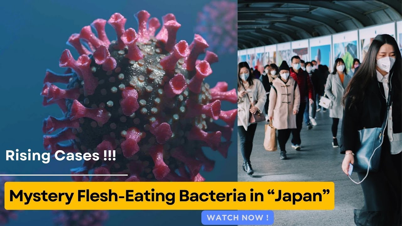Flesh-Eating Bacteria in Japan: More Dangerous Than COVID-19? | Japan ...