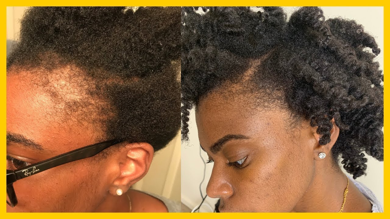HOW I GREW MY EDGES BACK (FAST) & WHAT I USED! - YouTube