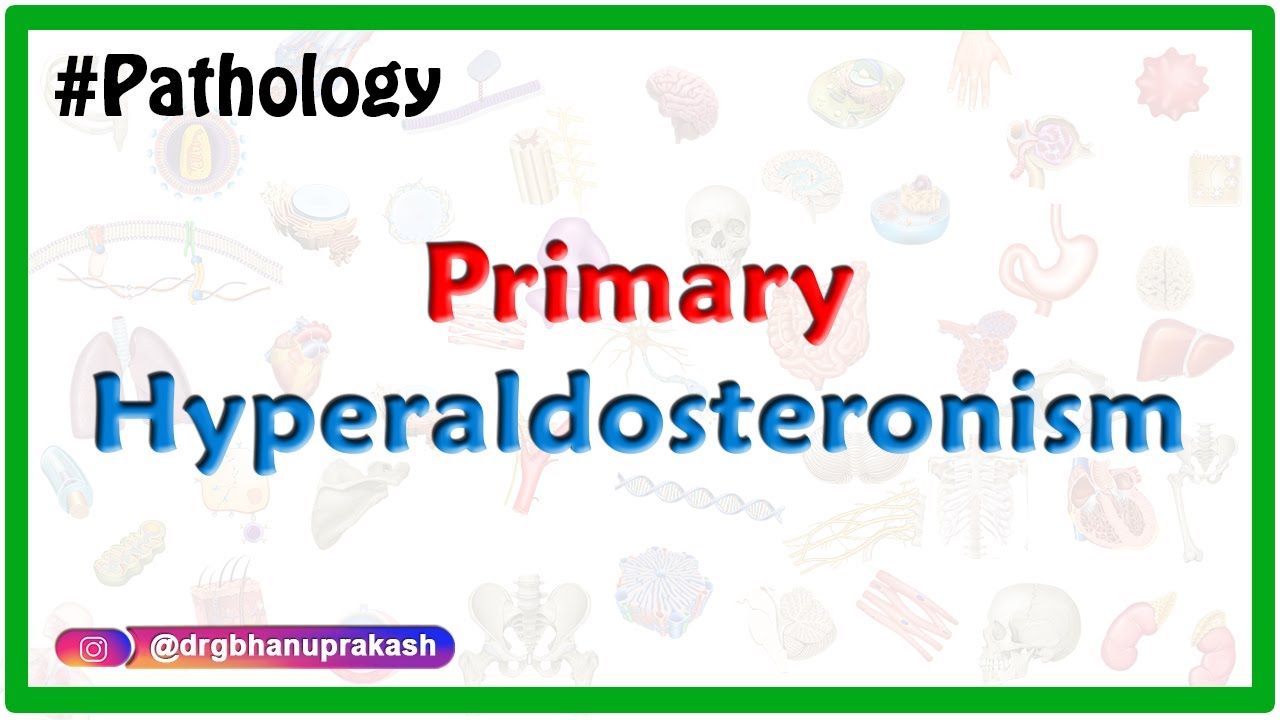 Primary Hyperaldosteronism / conn Syndrome : Etiology , Pathology ...