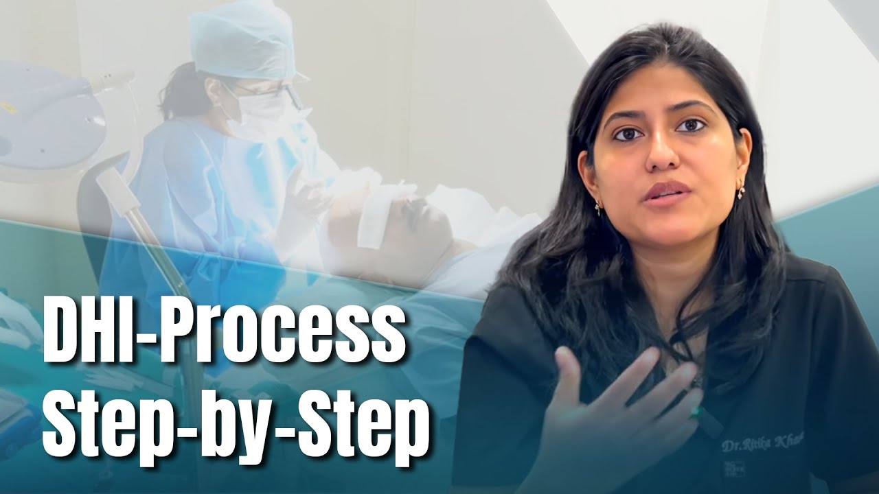 Dive into the Step-by-Step Process of DHI Hair Transplantation! - YouTube