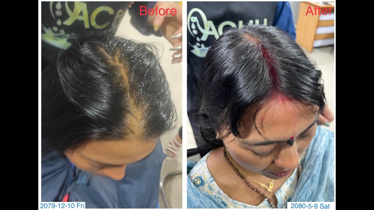 Honest Review | Yachu Hair Oil - YouTube