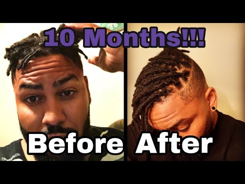 10 Month Loc Journey - YouTube