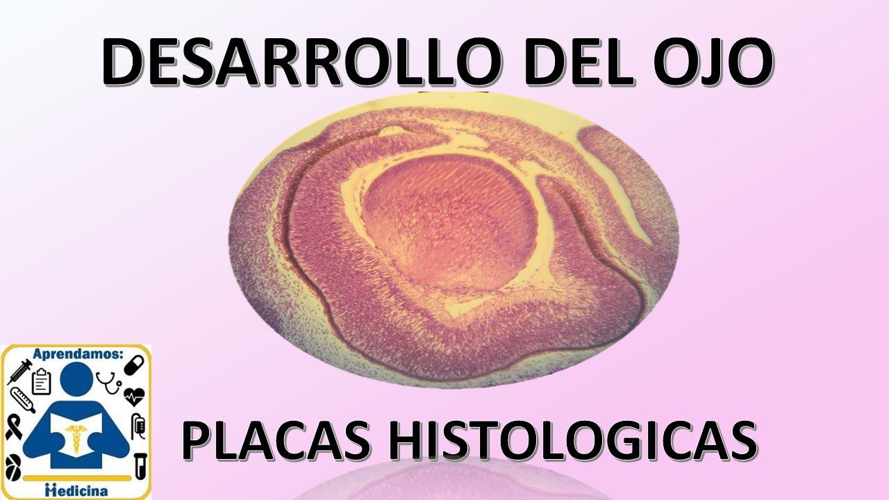 Embriologia: Desarrollo de ojo (Placas histologicas) - YouTube