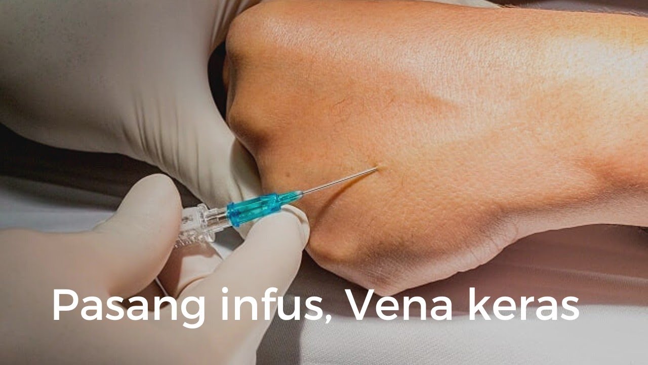 ketika di infus, Vena keras - YouTube