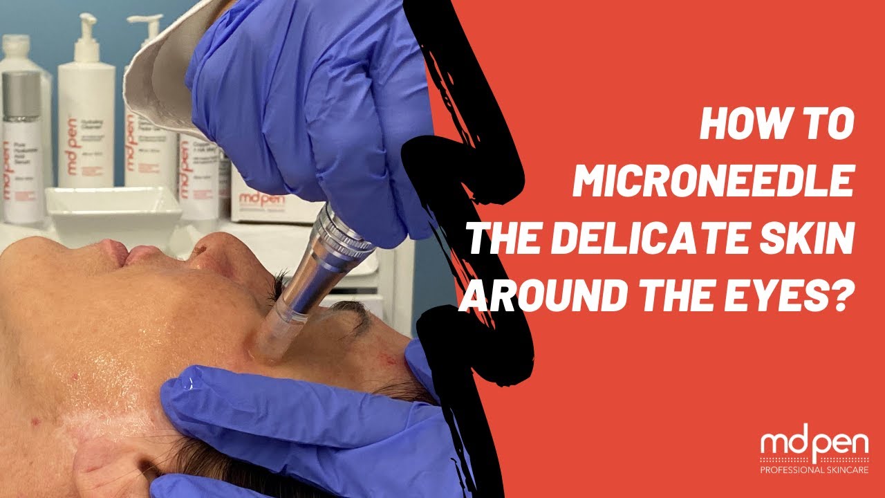How to Microneedle the delicate skin around the eyes? - YouTube