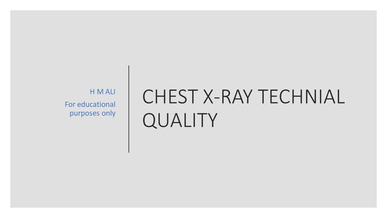AF SOMALI CHEST X-RAY CASHARKA 2 aad - YouTube
