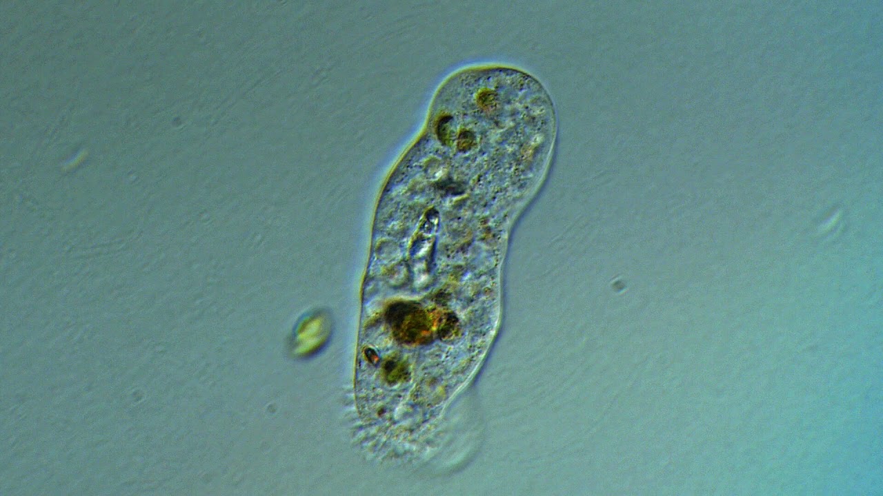 Amoebe, probably Vahlkampfia - YouTube