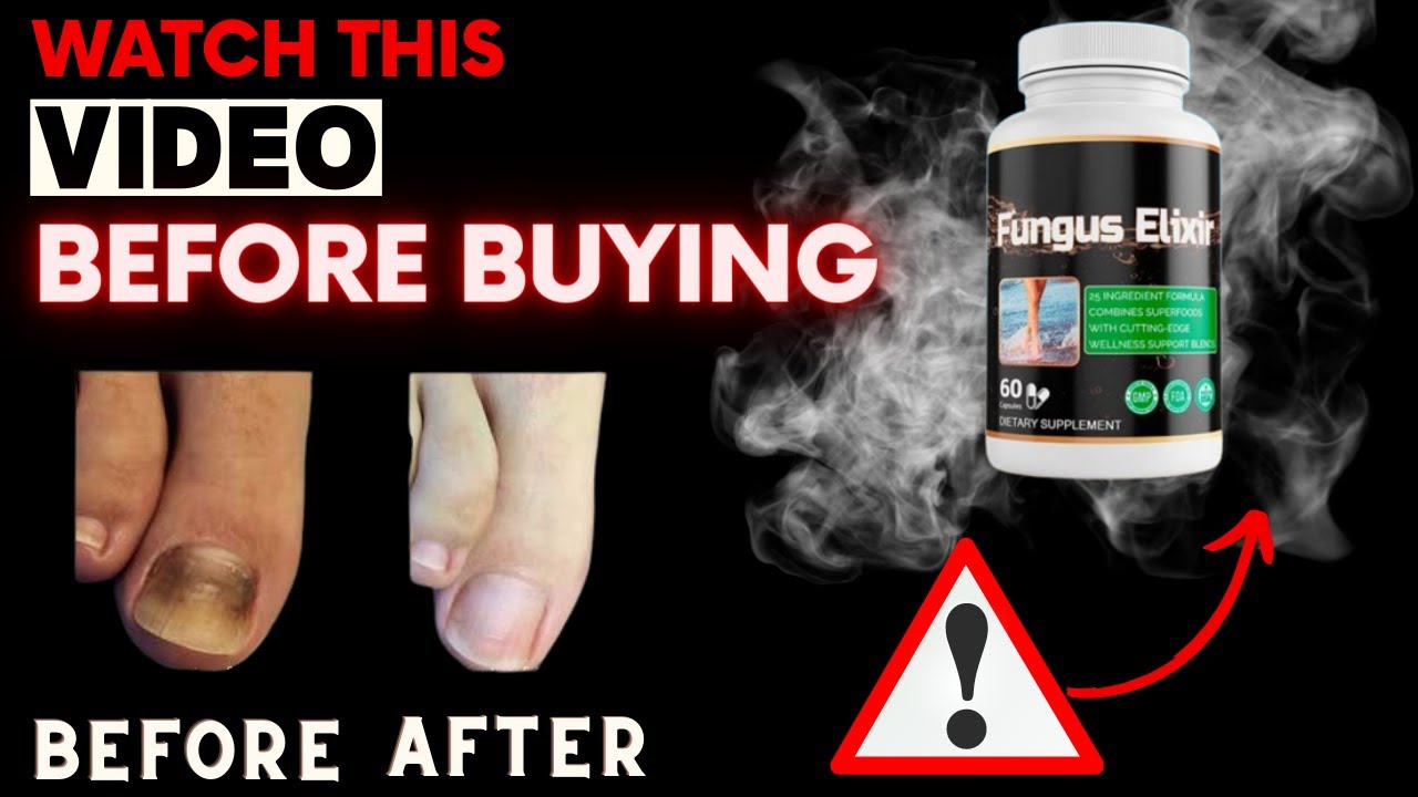 ⚠️ Fungus elixir review - Does Fungus elixir really work? Fungus elixir ...