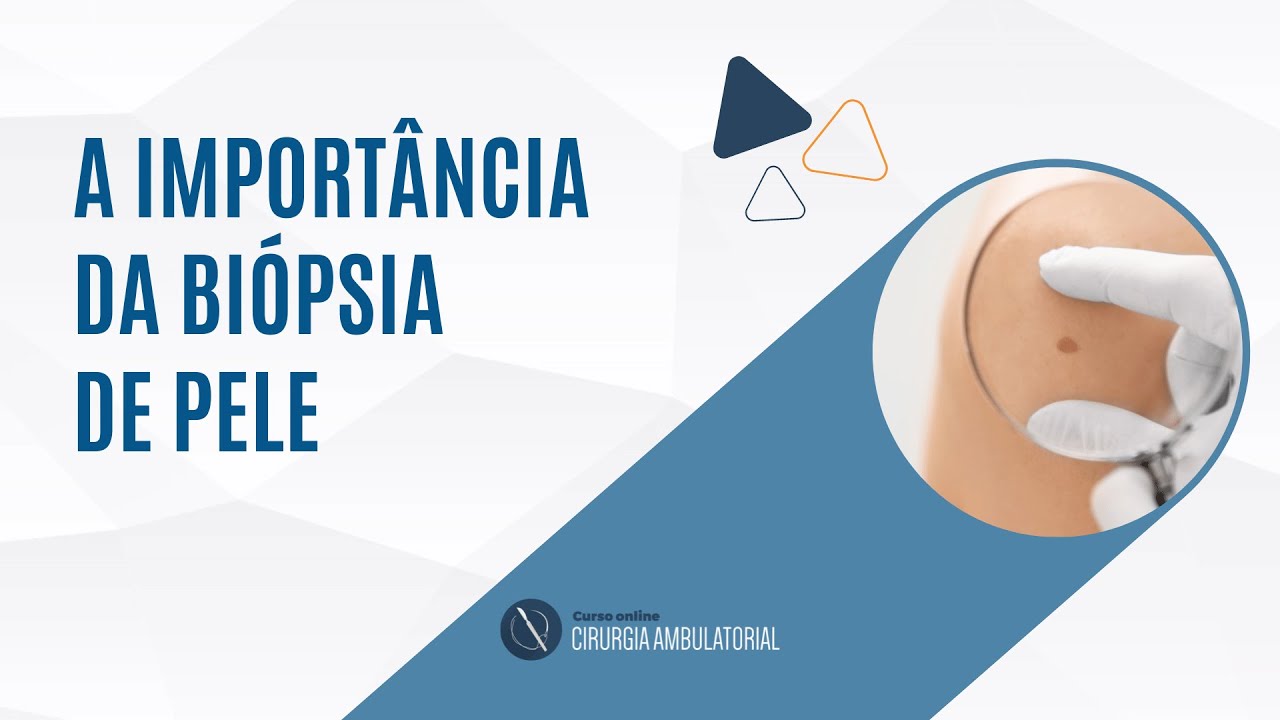 A importância das biópsia de pele - YouTube