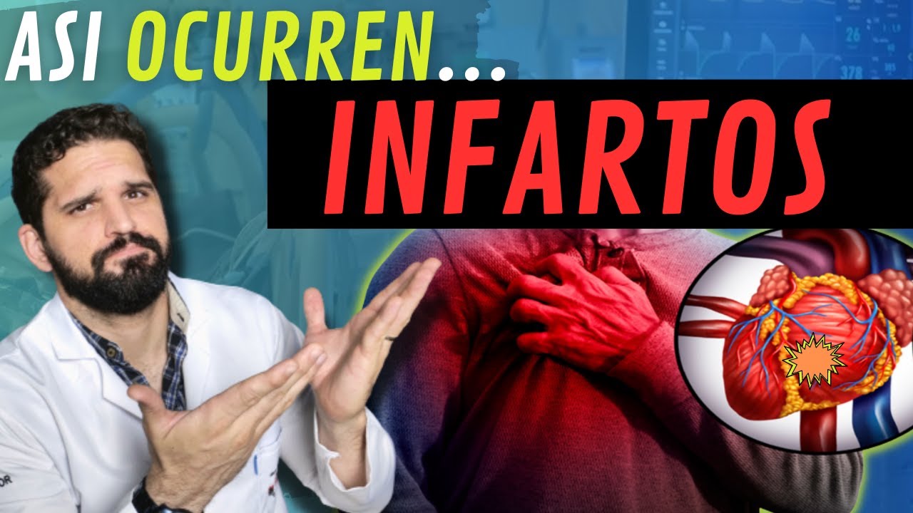 ¡SORPRENDENTE¡ Asi es como OCURREN los INFARTOS AL CORAZÓN 😳🩺 - YouTube