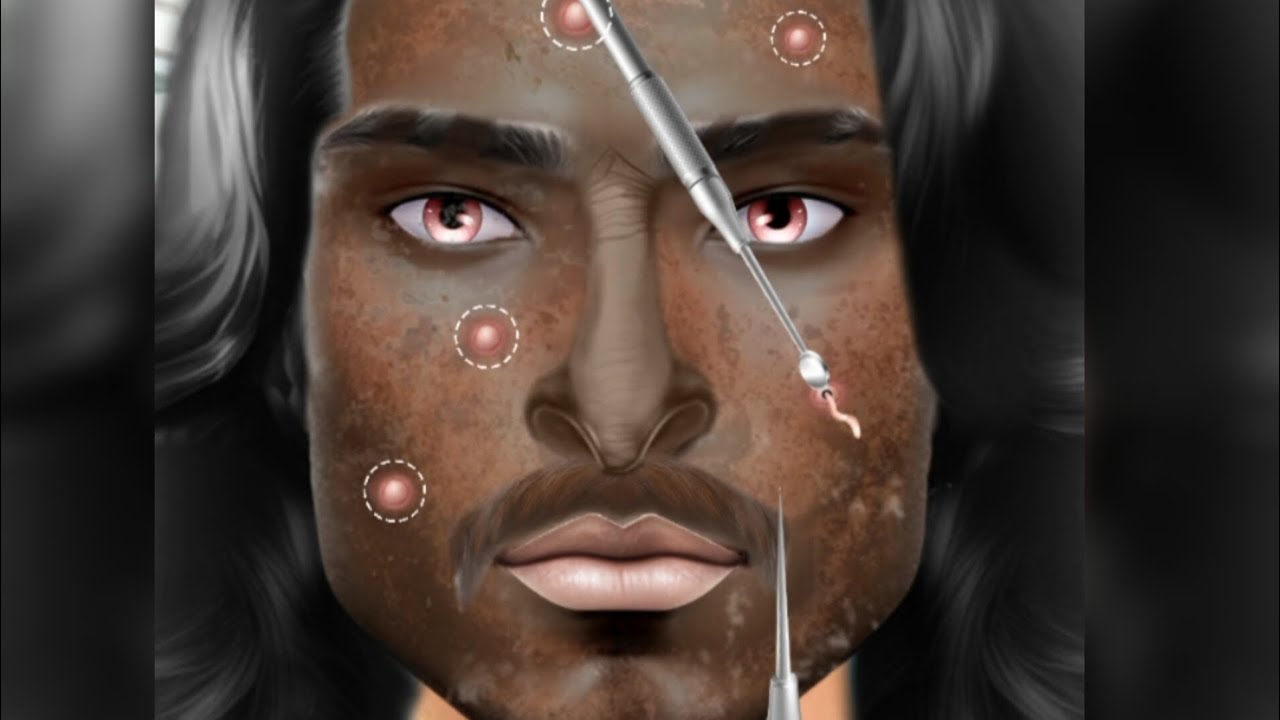 Make ugly face beautiful,Makeover games,makeup transformation - YouTube