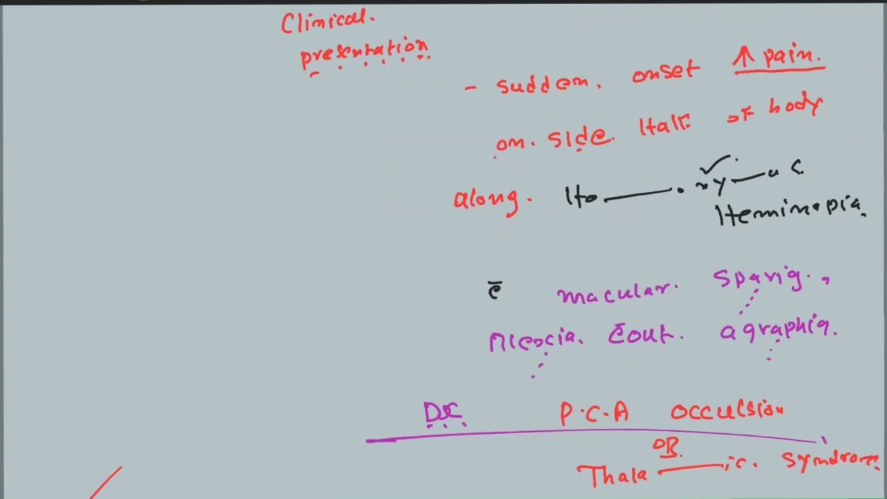 B.S-Lec:16 stroke of AICA& SCA 532 part:7 #drzahidlectures #zmsa #MSS # ...