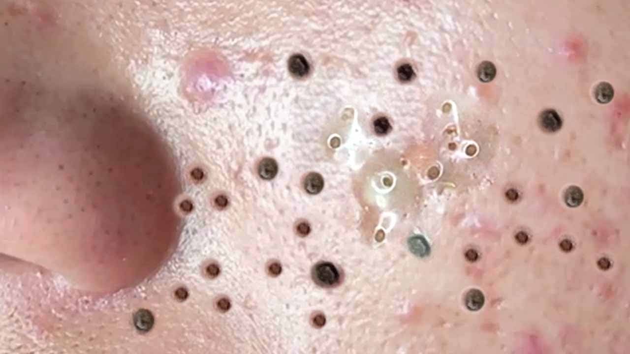 𝐋𝐮𝐱𝐮𝐫𝐲 𝐏𝐫𝐨𝐟𝐞𝐬𝐬𝐢𝐨𝐧𝐚𝐥 𝐅𝐚𝐜𝐢𝐚𝐥 𝐖𝐢𝐭𝐡 𝐋𝐍 𝐒𝐩𝐚 #𝟏𝟒𝟑 - YouTube