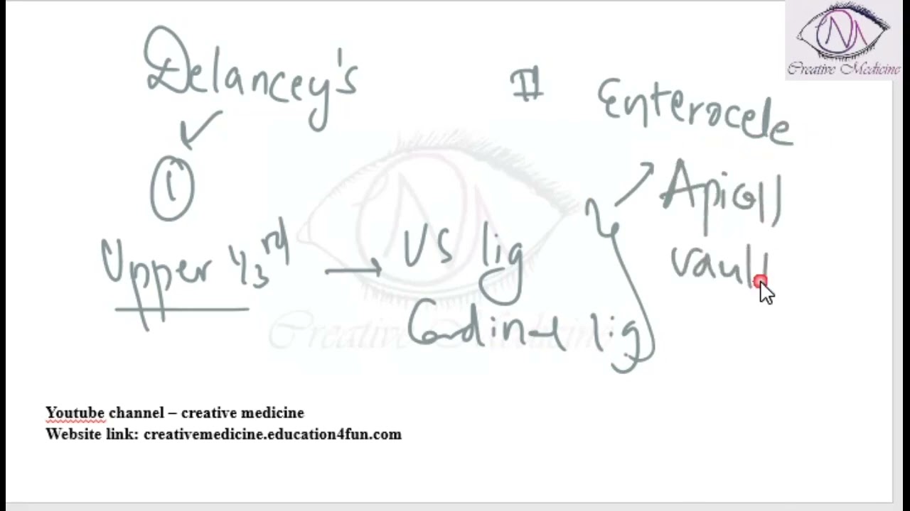 Lec 22 Uterine Prolapse DeLancey Classification - YouTube