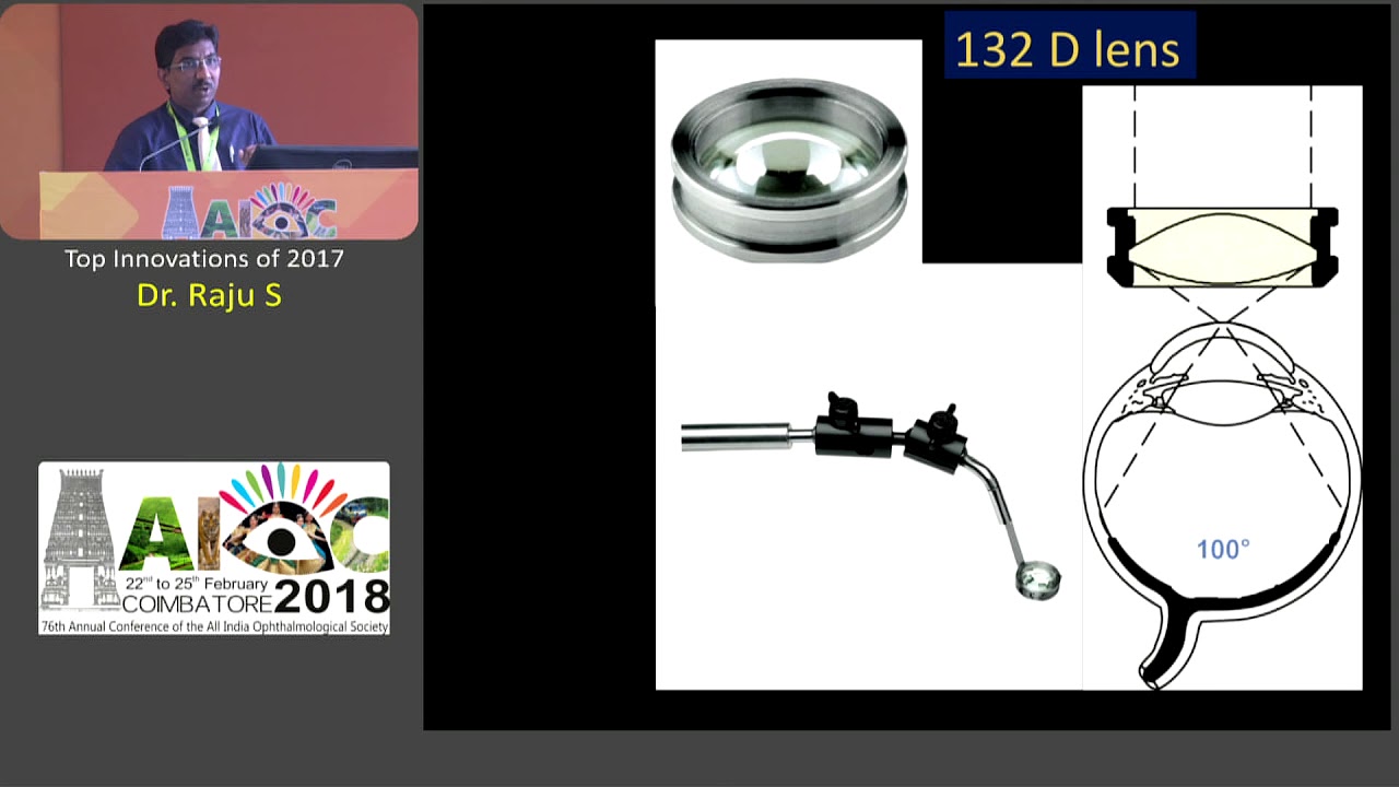 AIOC2018 - GP134 - Topic - Wide Angle Viewing System - YouTube