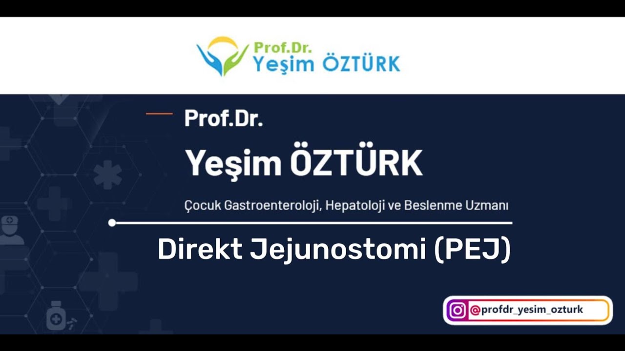 Perkütan endoskopik jejunostomi (DPEJ) - YouTube