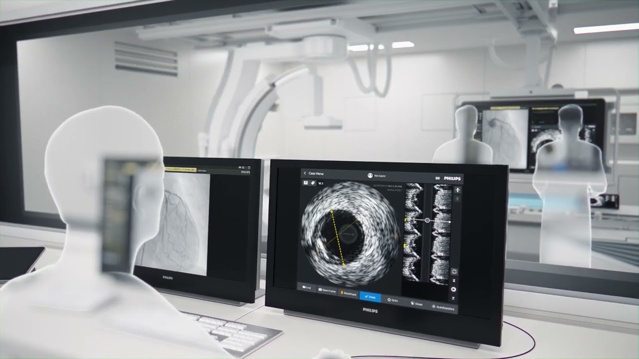 Philips IntraSight Interventional Applications Platform - YouTube