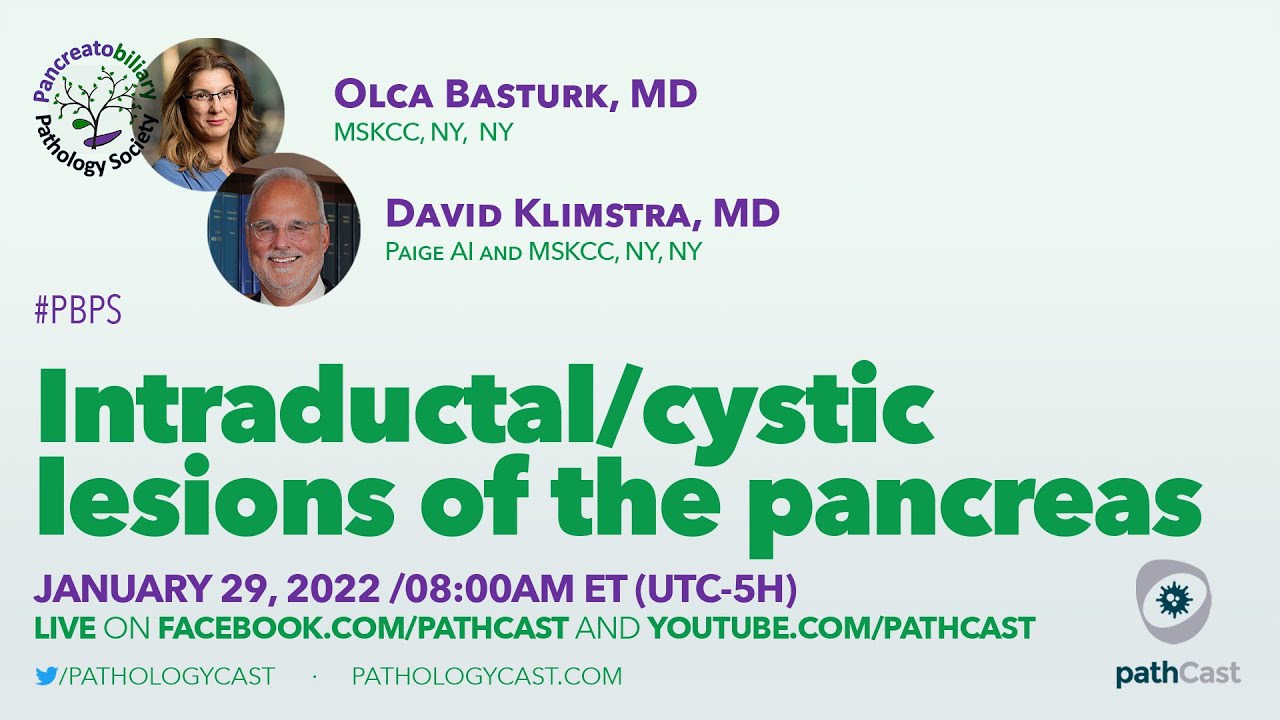 Intraductal/cystic lesions of the pancreas - Drs. Basturk & Klimstra ...