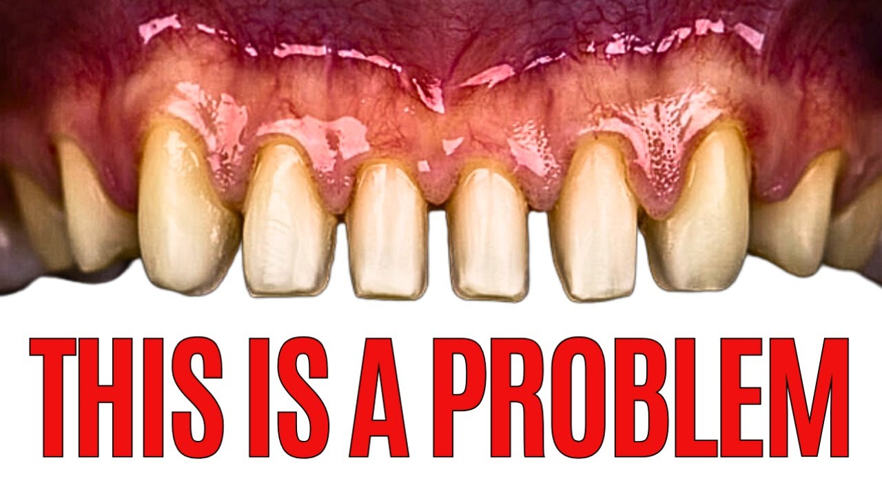 Here's How Turkish Dentists Are Destroying Teeth - YouTube