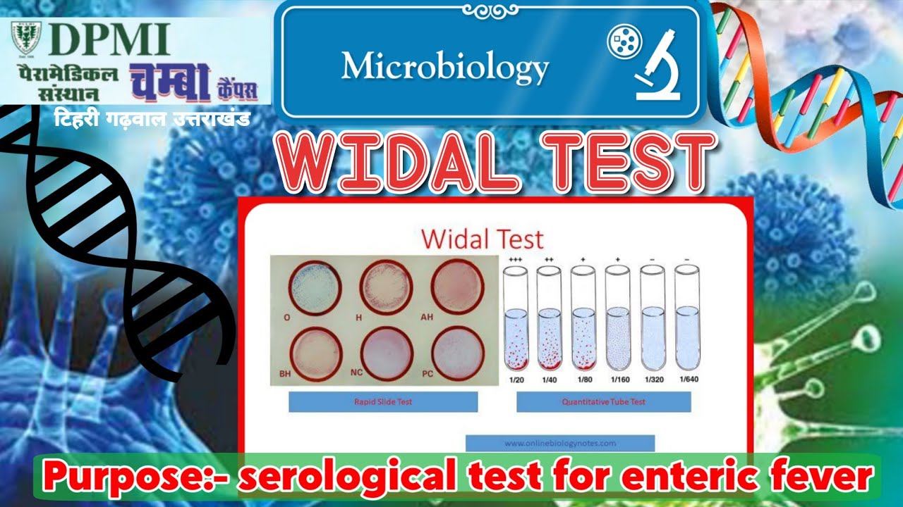 Widal Test | serological test for enteric fever - YouTube