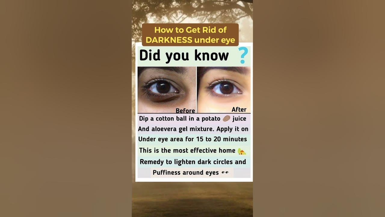 How To Get Rid Of Darkness Under Eyes Remove Dark Eye Circles how-to-get-rid-of-darkness-under-eyes-remove-dark-eye-circles
