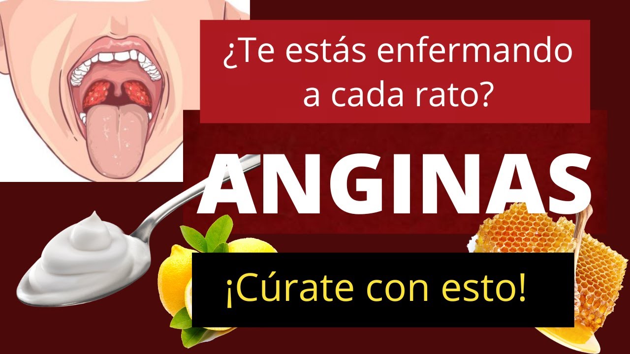 ¿YA NO AGUANTAS LAS ANGINAS Y TE ESTÁS ENFERMANDO A CADA RATO? ¡Cúrate ...