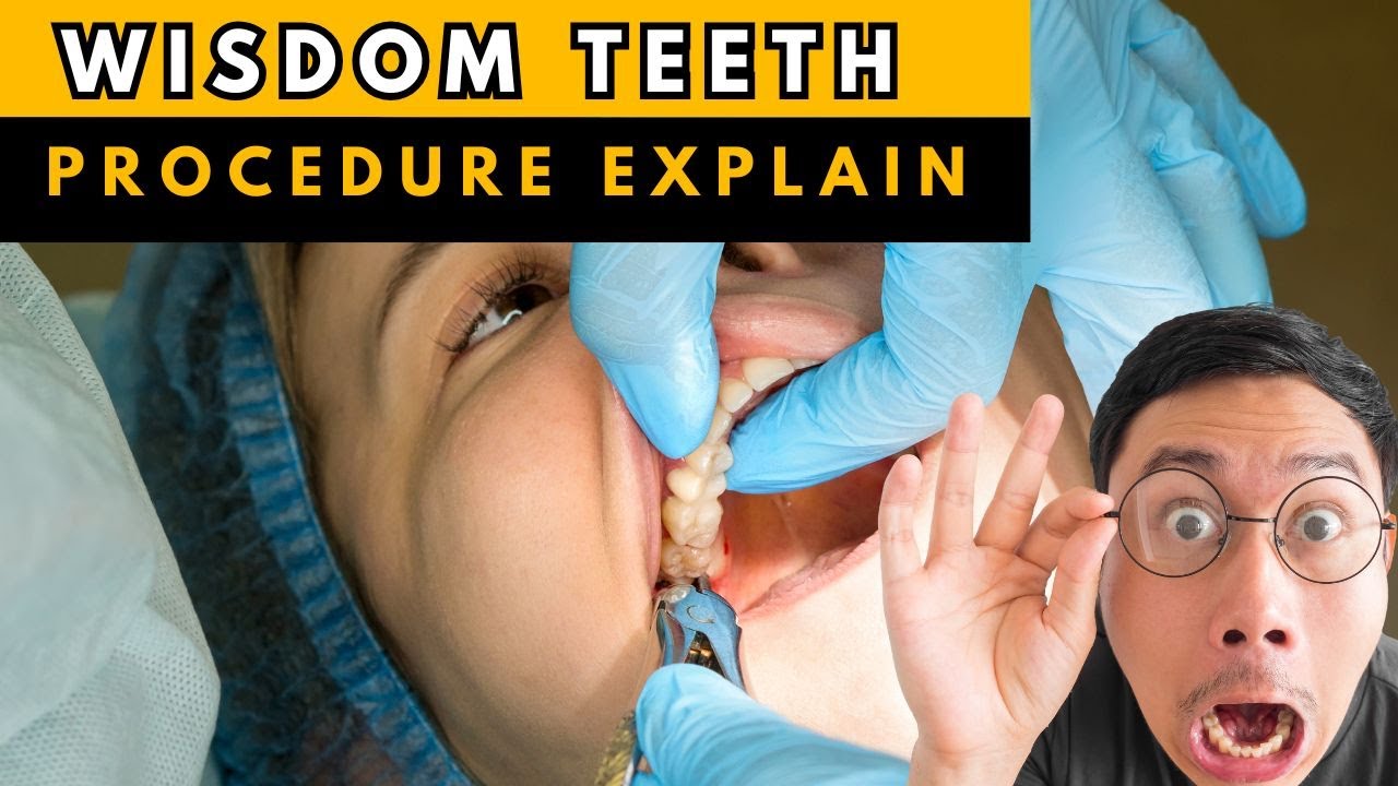 Wisdom Teeth Extraction - step by step - YouTube