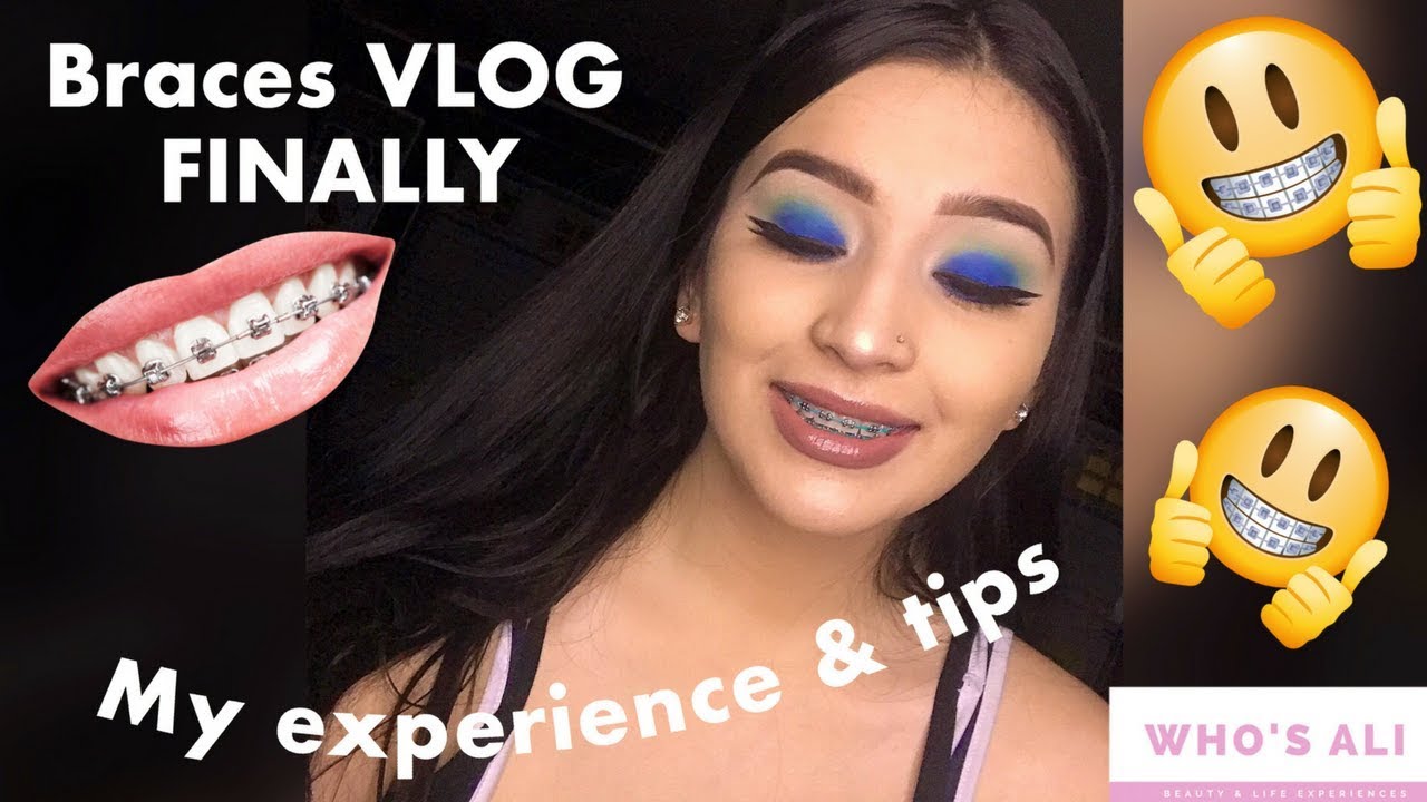 ABOUT BRACES : TIPS & ADVICE - YouTube
