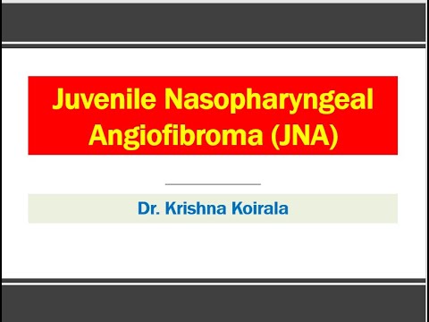 Juvenile Nasopharyngeal Angiofibroma(JNA) //Dr. Krishna's ENT Lectures ...