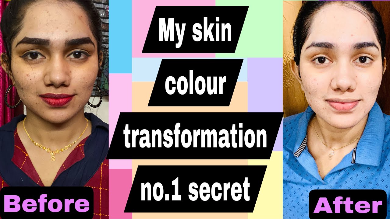 No.1 secret skin colour transformation remedy 100% results guaranteed💯 ...