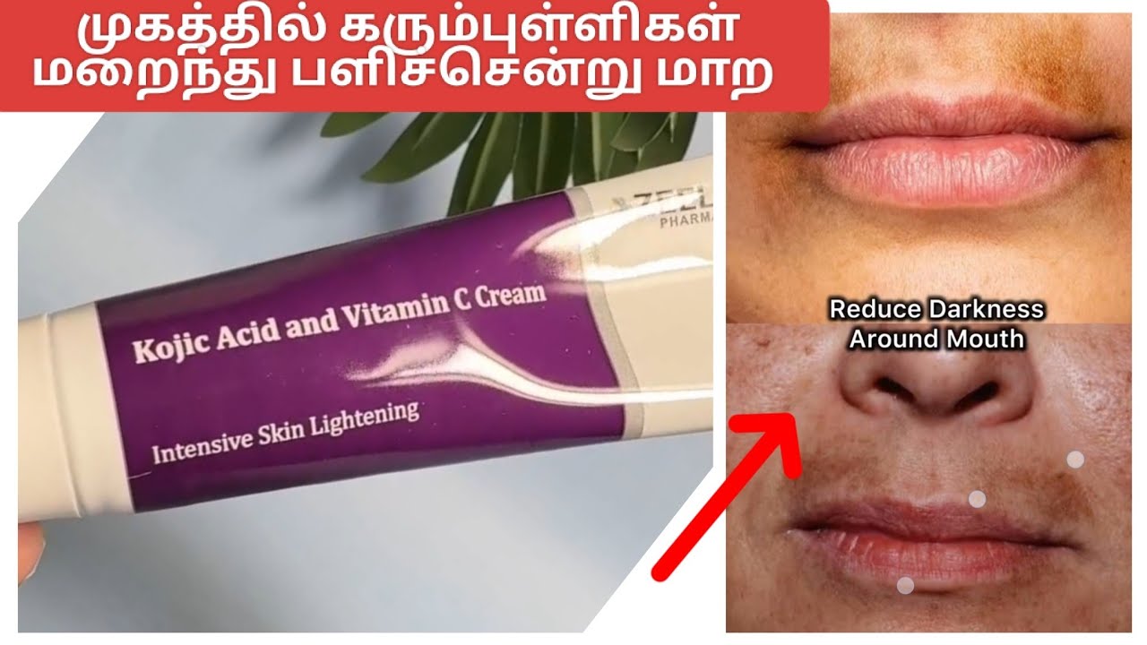 zeelab kojic acid and vitamin c cream review #skinwhiteningcream - YouTube