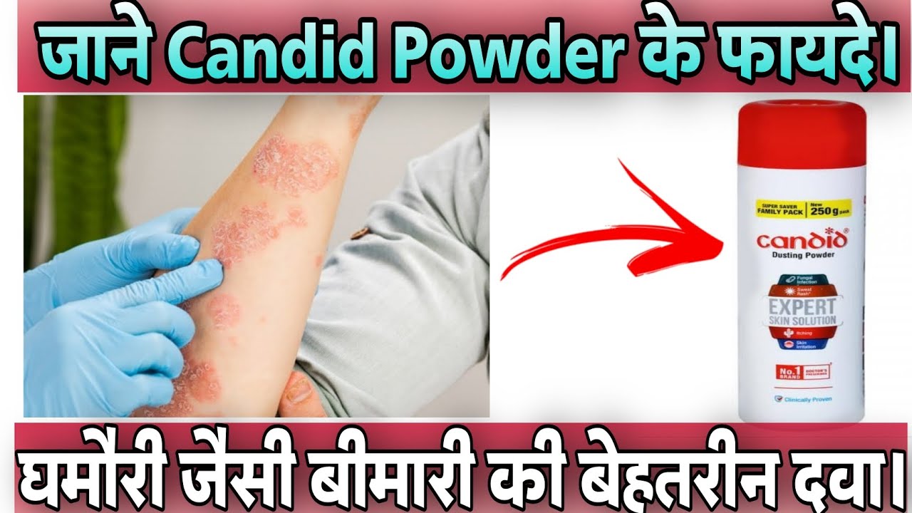Candid powder के फायदे क्या-क्या है? घमौरी, दाद, खुजली, में उपयोग होने ...