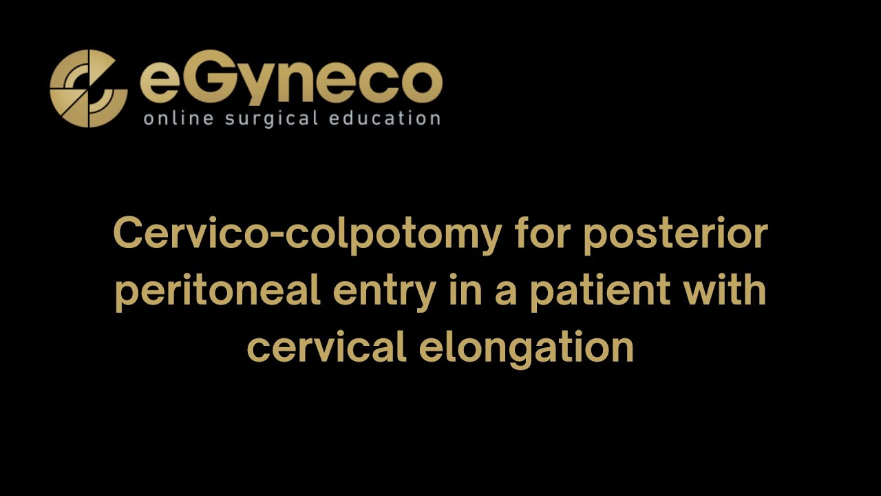 The unusual cervico-colpotomy procedure - YouTube